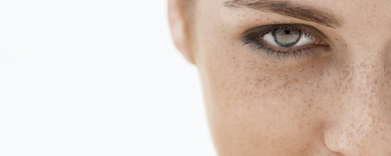 How to Tell the Difference Between a Freckle and Skin Cancer︱GentleCure