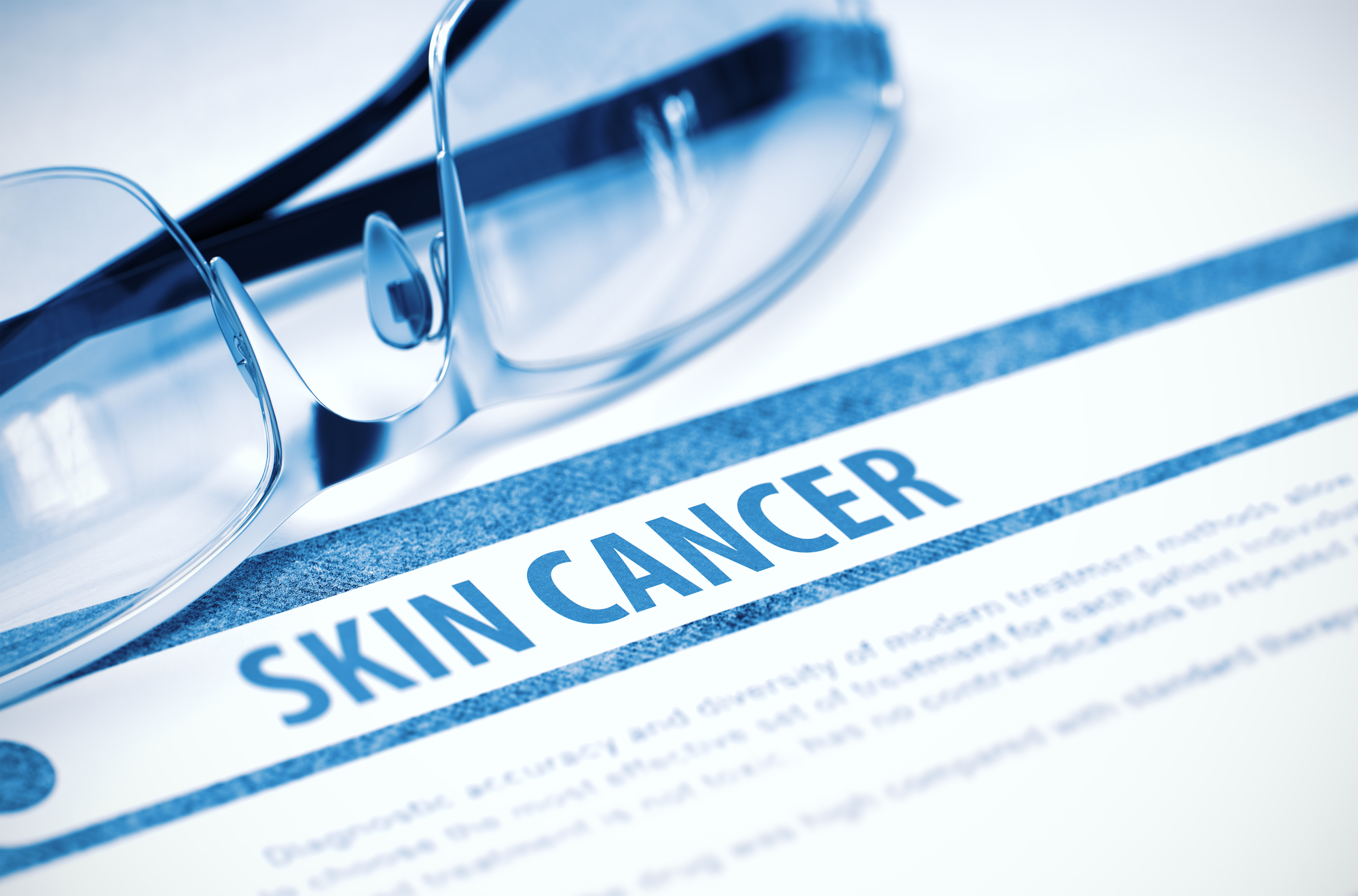 Advances in Melanoma and Skin Cancer Research | GentleCure