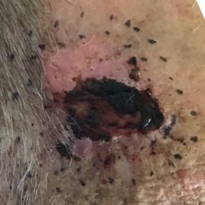 Bleeding or Scabbing Spot: When to Worry and When to Get Checked